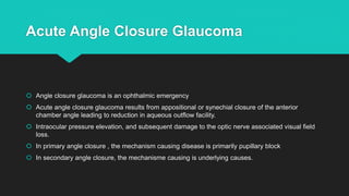 acute angle closure.pptx