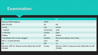 acute angle closure.pptx