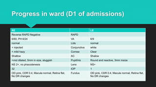 acute angle closure.pptx