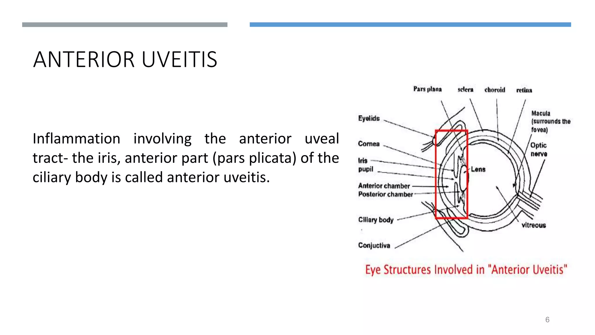 Acute anterior uveitis by Dr. Rubana.pptx
