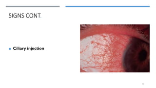 Acute anterior uveitis by Dr. Rubana.pptx