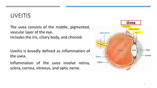 Acute anterior uveitis by Dr. Rubana.pptx