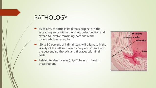 Acute aortic dissection | PPTX