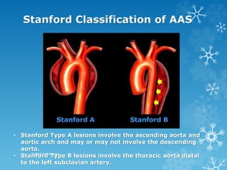 Acute Aortic Syndrome | PPTX