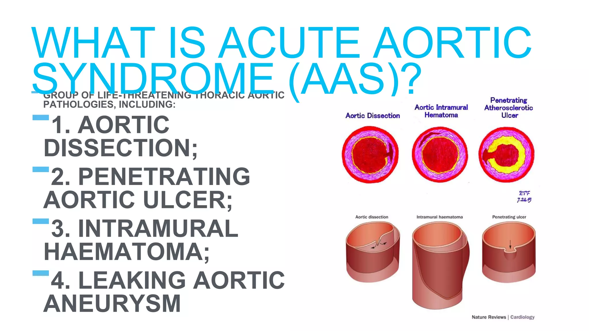 Acute aortic syndrome | PPTX