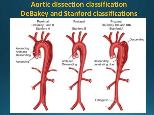 Acute aortic syndromes