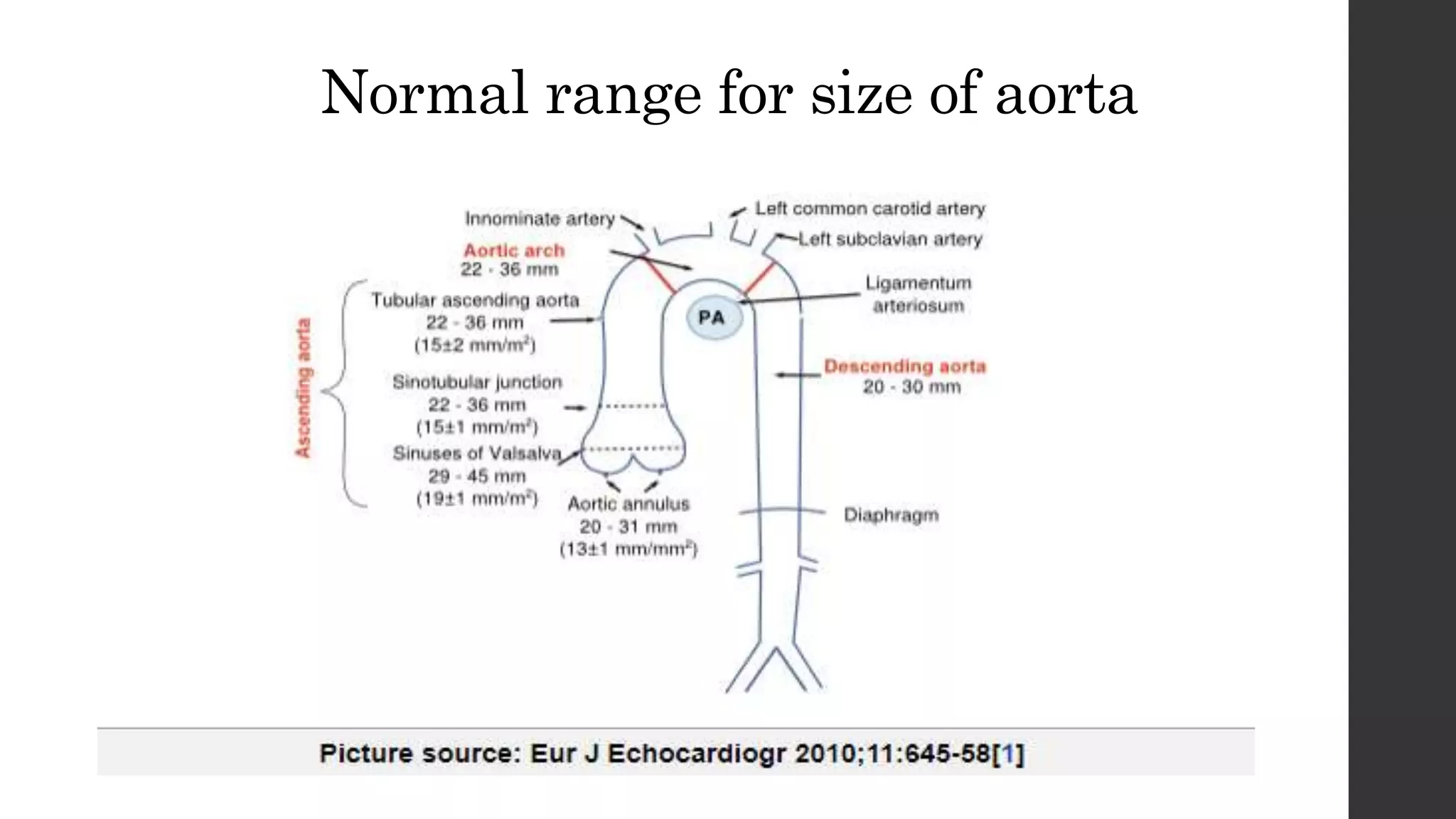 Acute aortic syndromes | PPTX