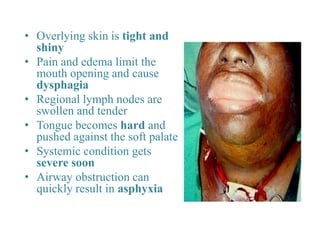 Acute apical abscess dr anirudh singh chauhan | PPTX