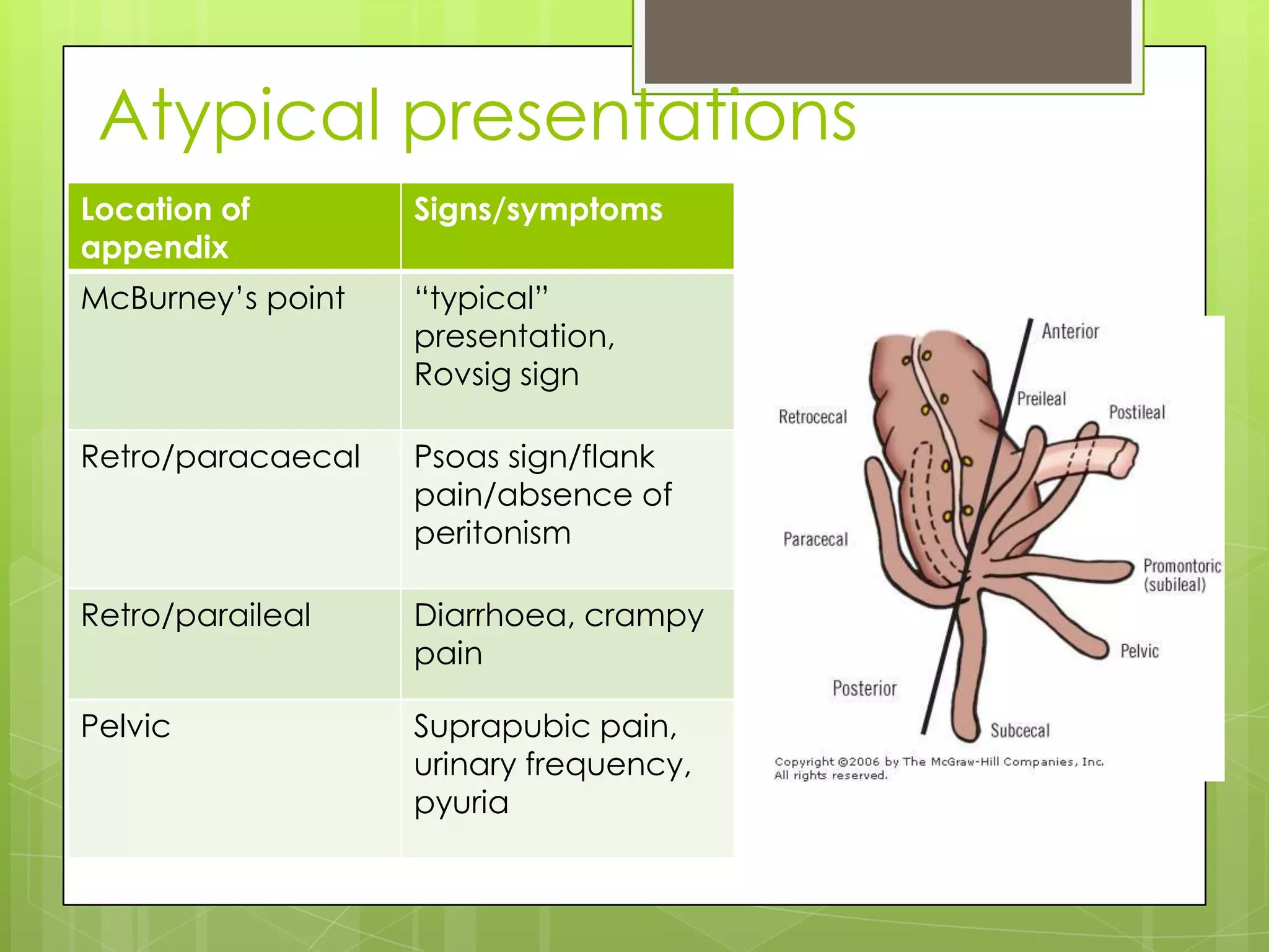 Acute appendicitis | PPTX