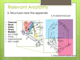 Acute appendicitis | PPTX