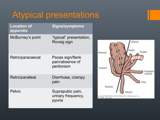 Acute appendicitis | PPT | Digestive Disorders | Diseases and Conditions