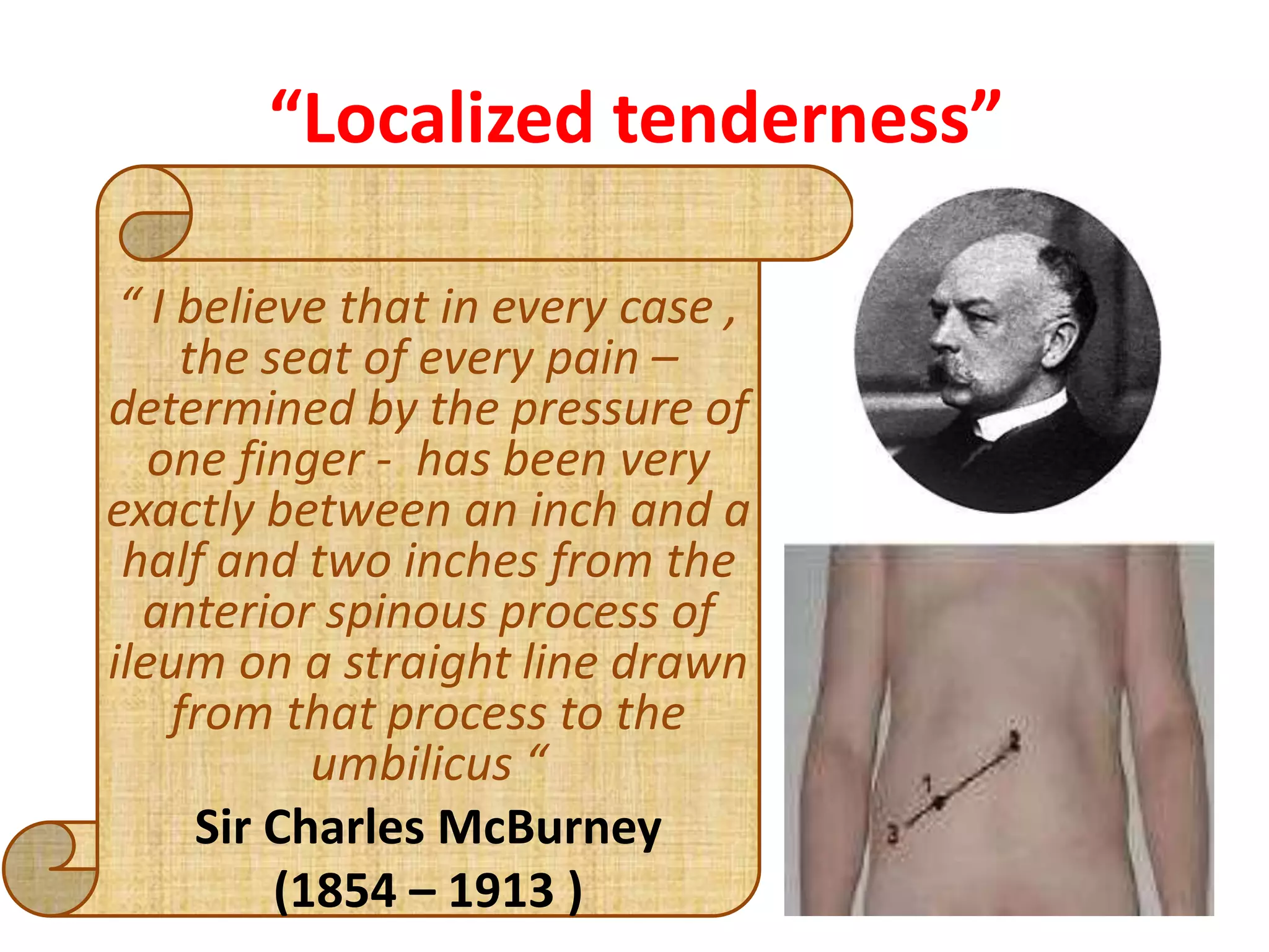 Acute appendicitis | PPTX