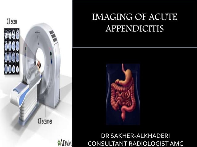 Imaging of Acute Appendicitis | PPTX