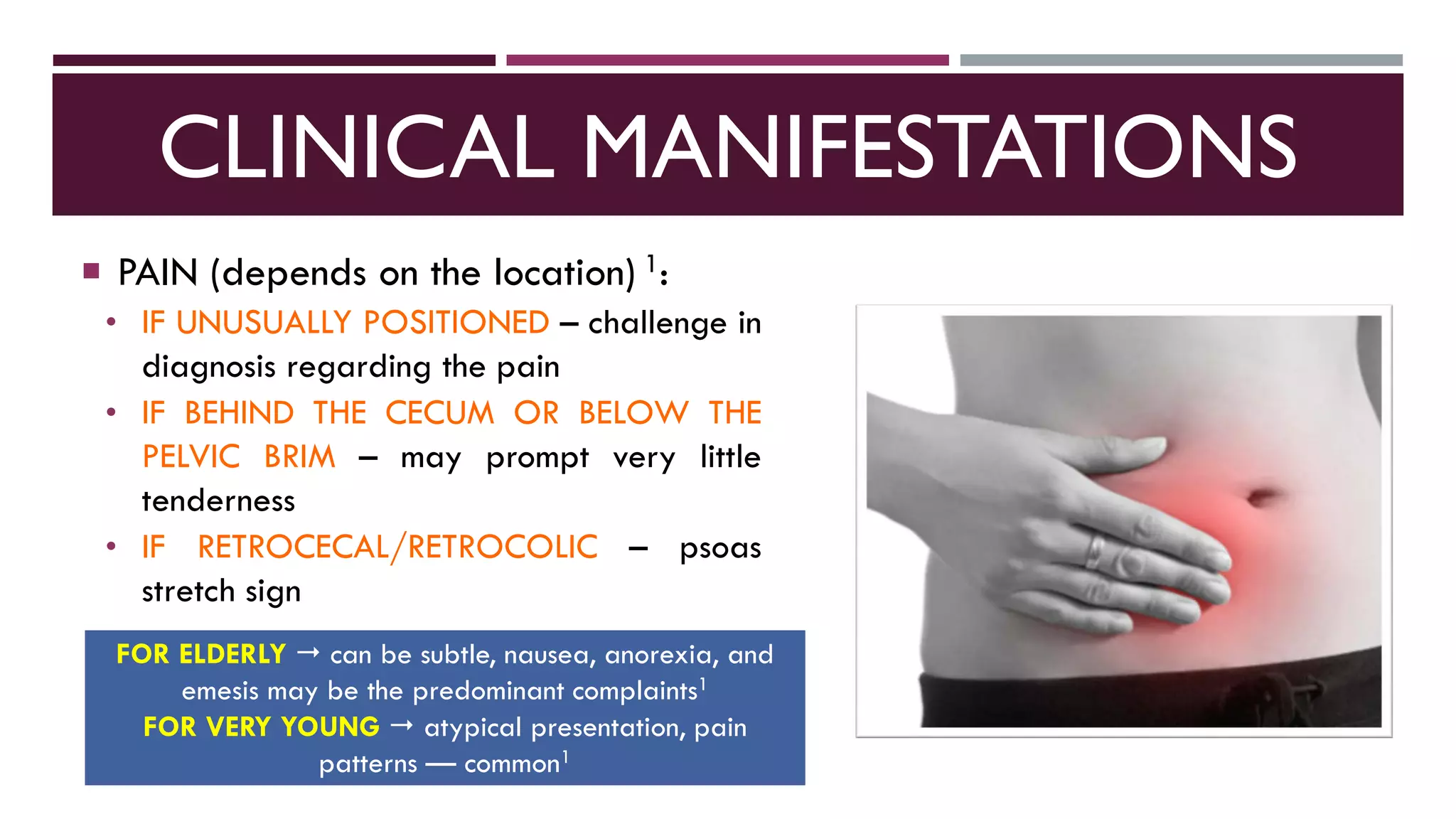 Acute Appendicitis | PDF