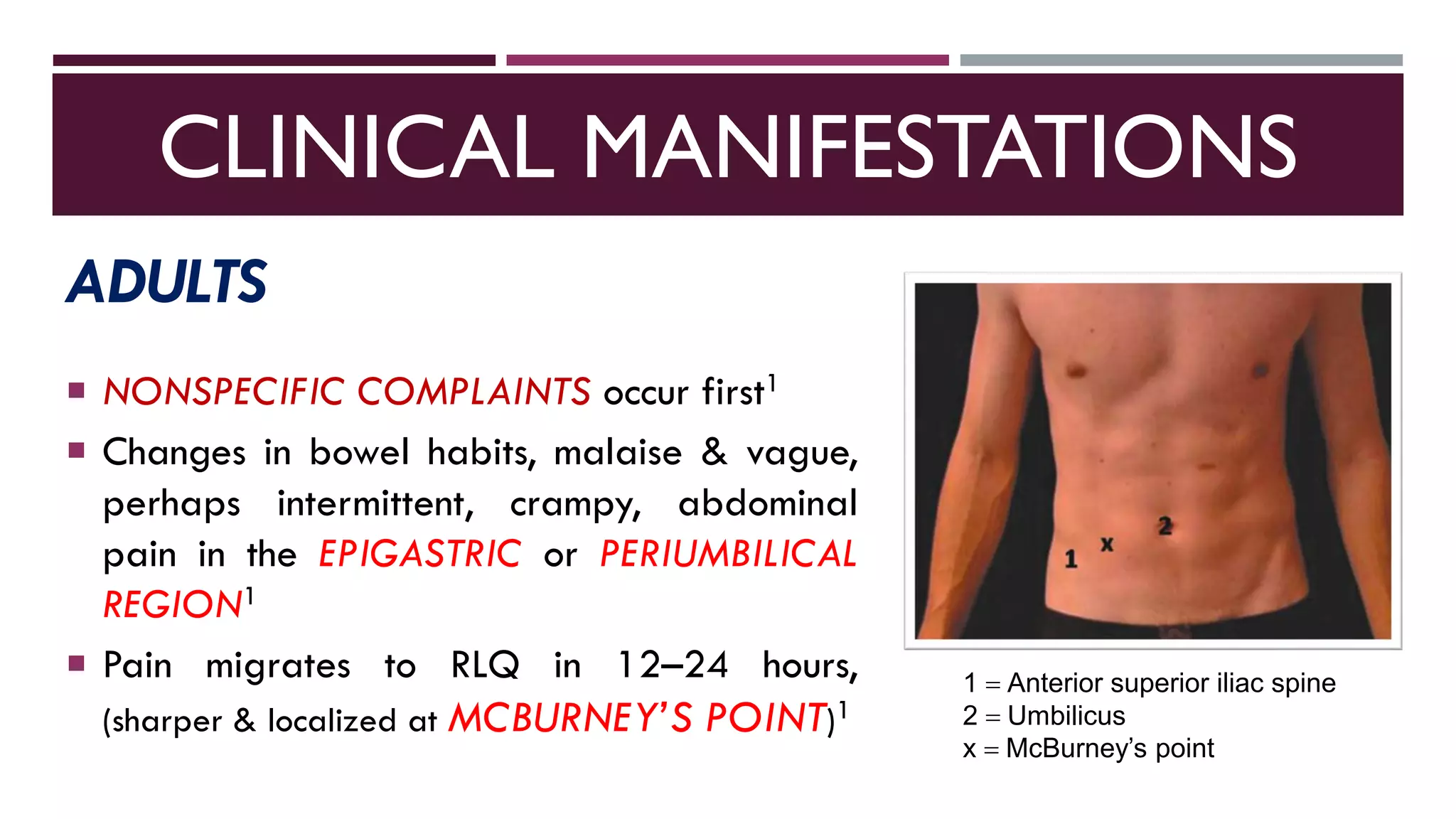 Acute Appendicitis | PDF