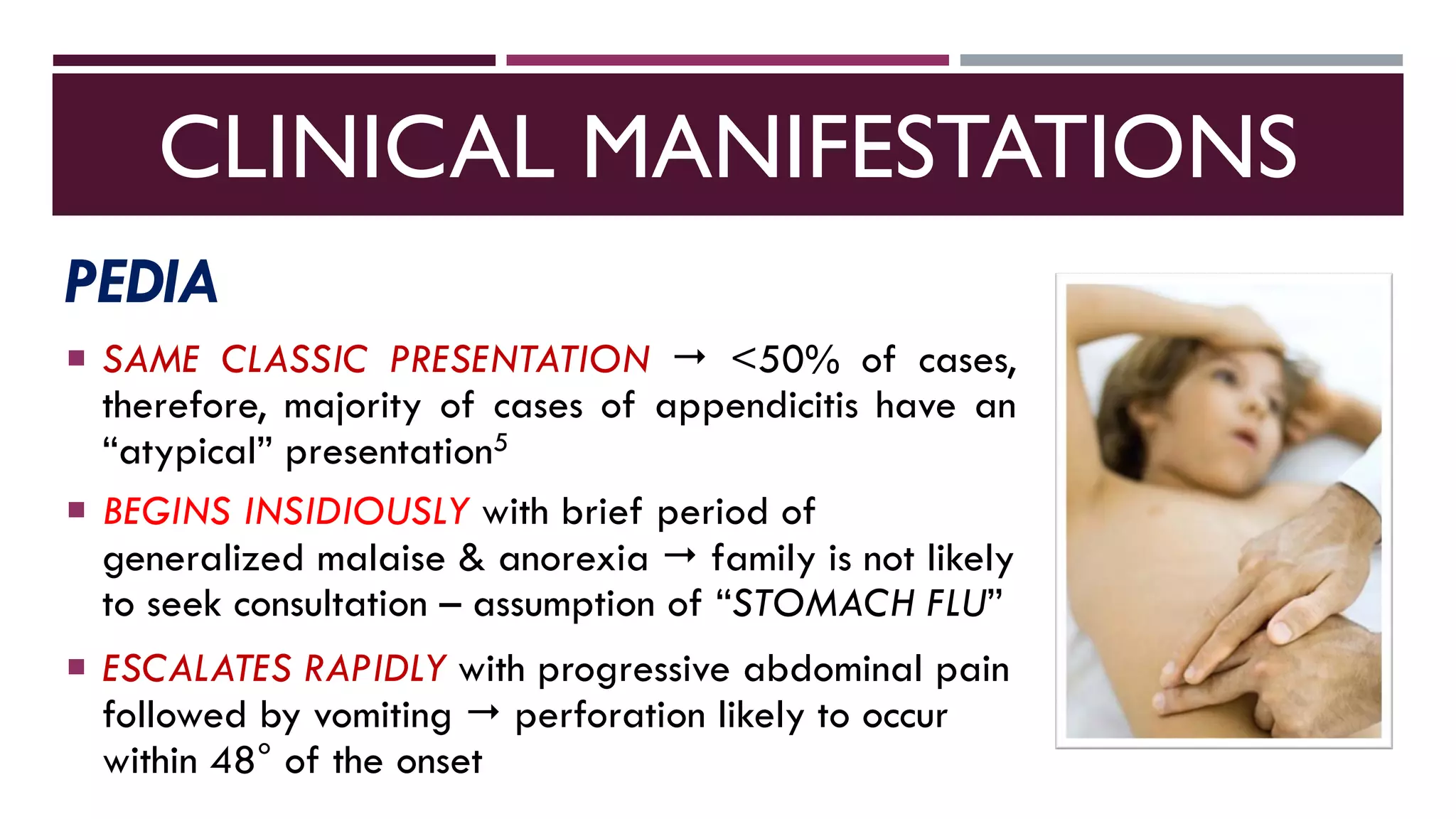 Acute Appendicitis | PDF