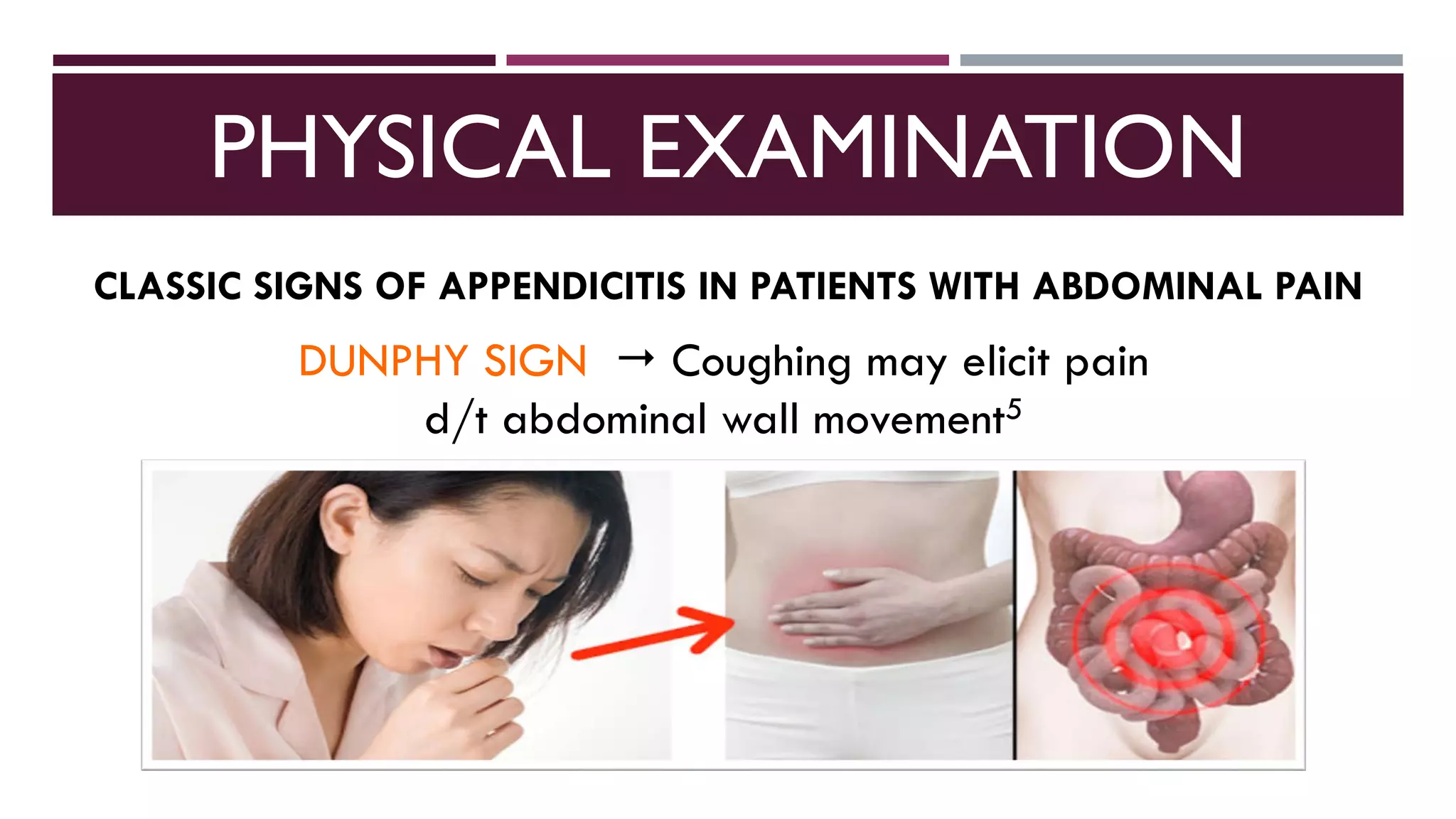 Acute Appendicitis | PDF