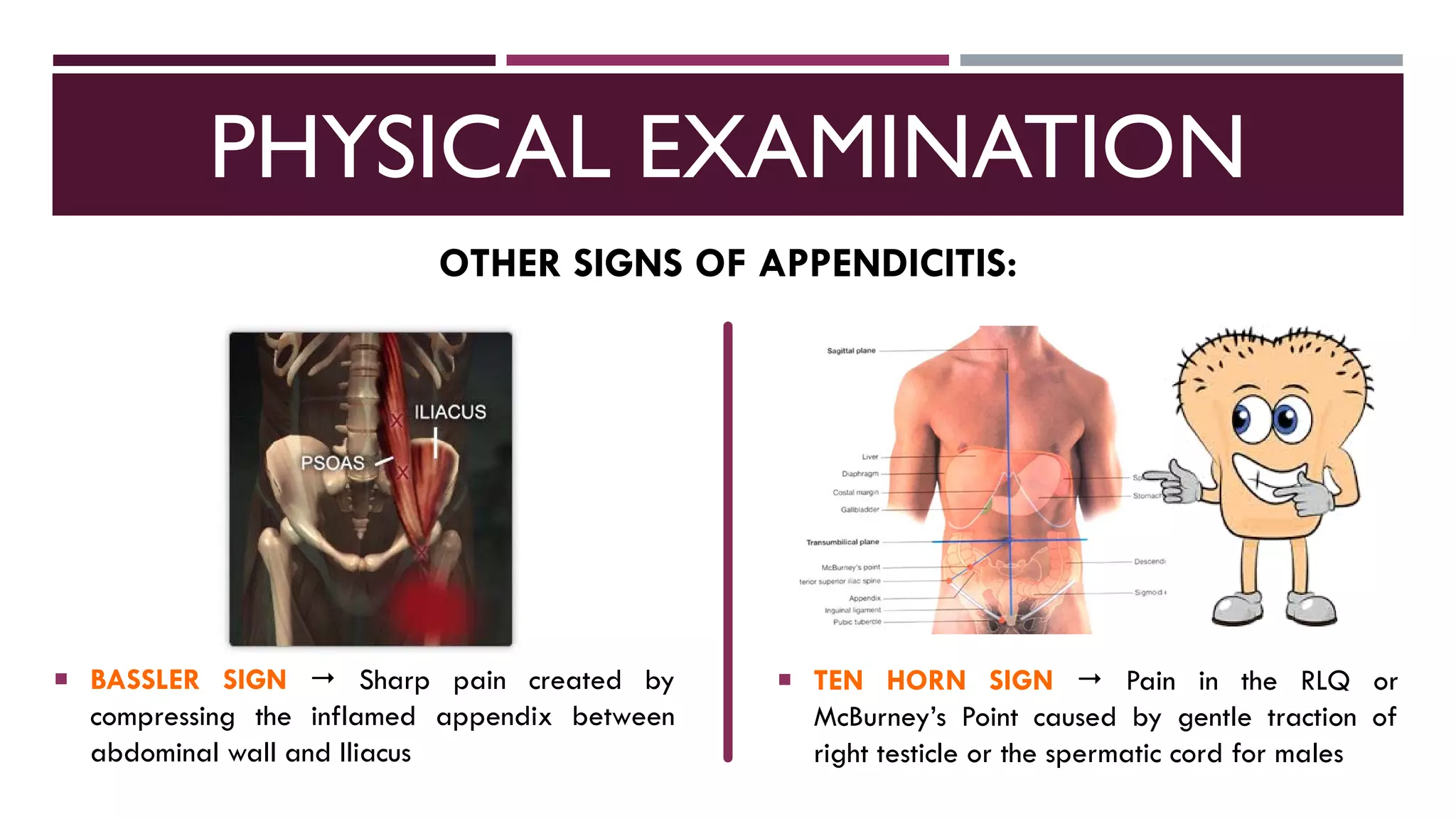 Acute Appendicitis | PDF