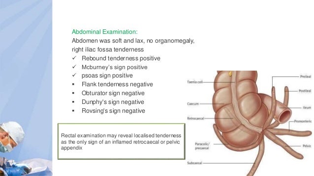 Acute appendicitis -Case Presentation
