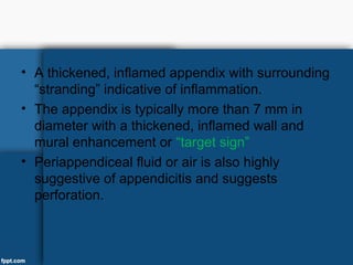 Acute appendicitis | PPT