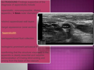 Acute appendicitis | PPTX