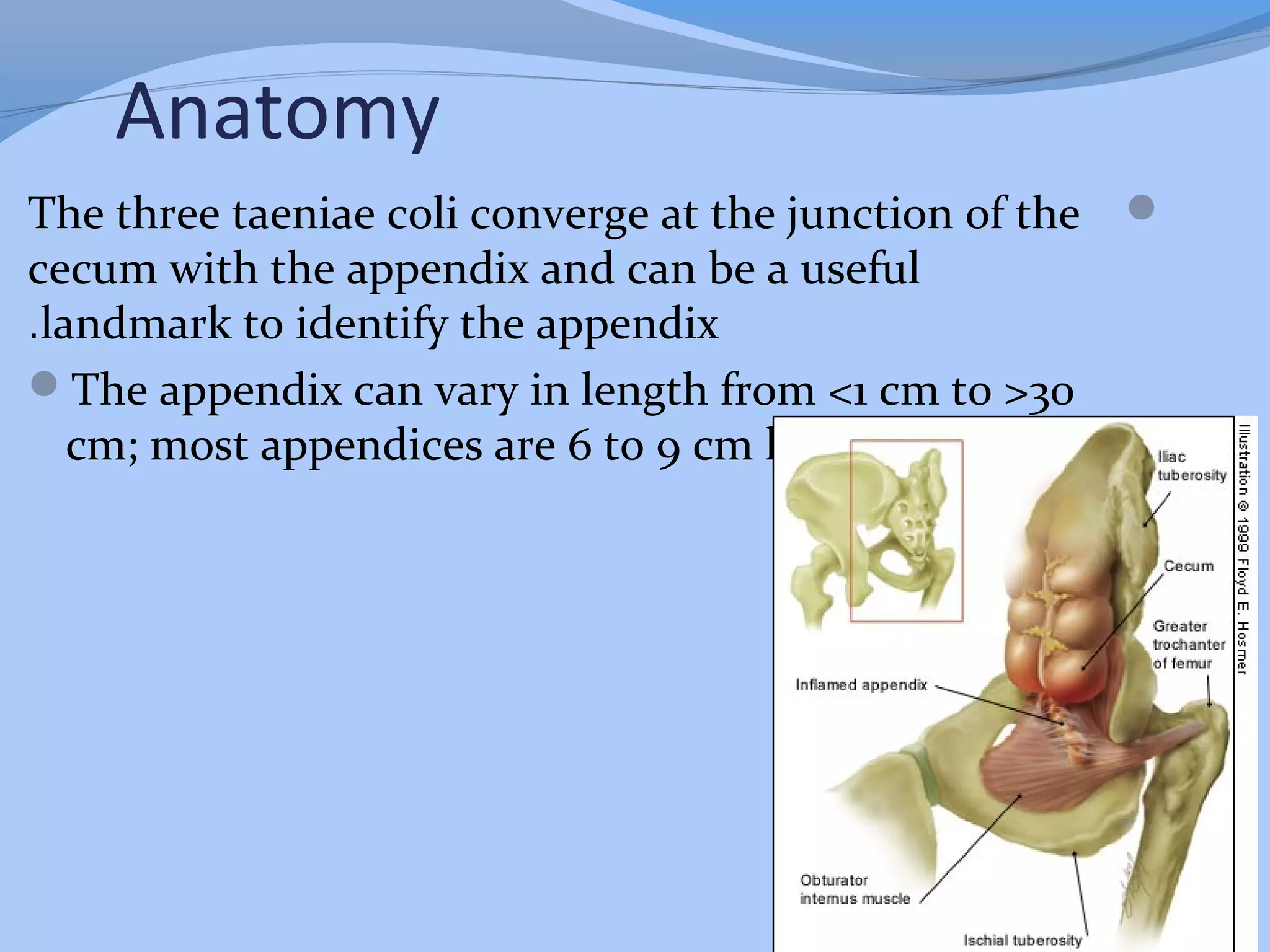 Acute appendicitis __ | PPT