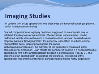Acute appendicitis __ | PPT