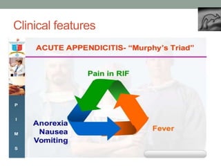 Acute appendicitis | PPTX