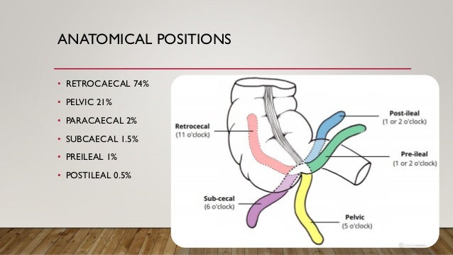 Acute appendicitis