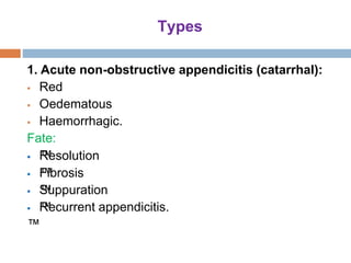 Acute appendicitis | PPTX