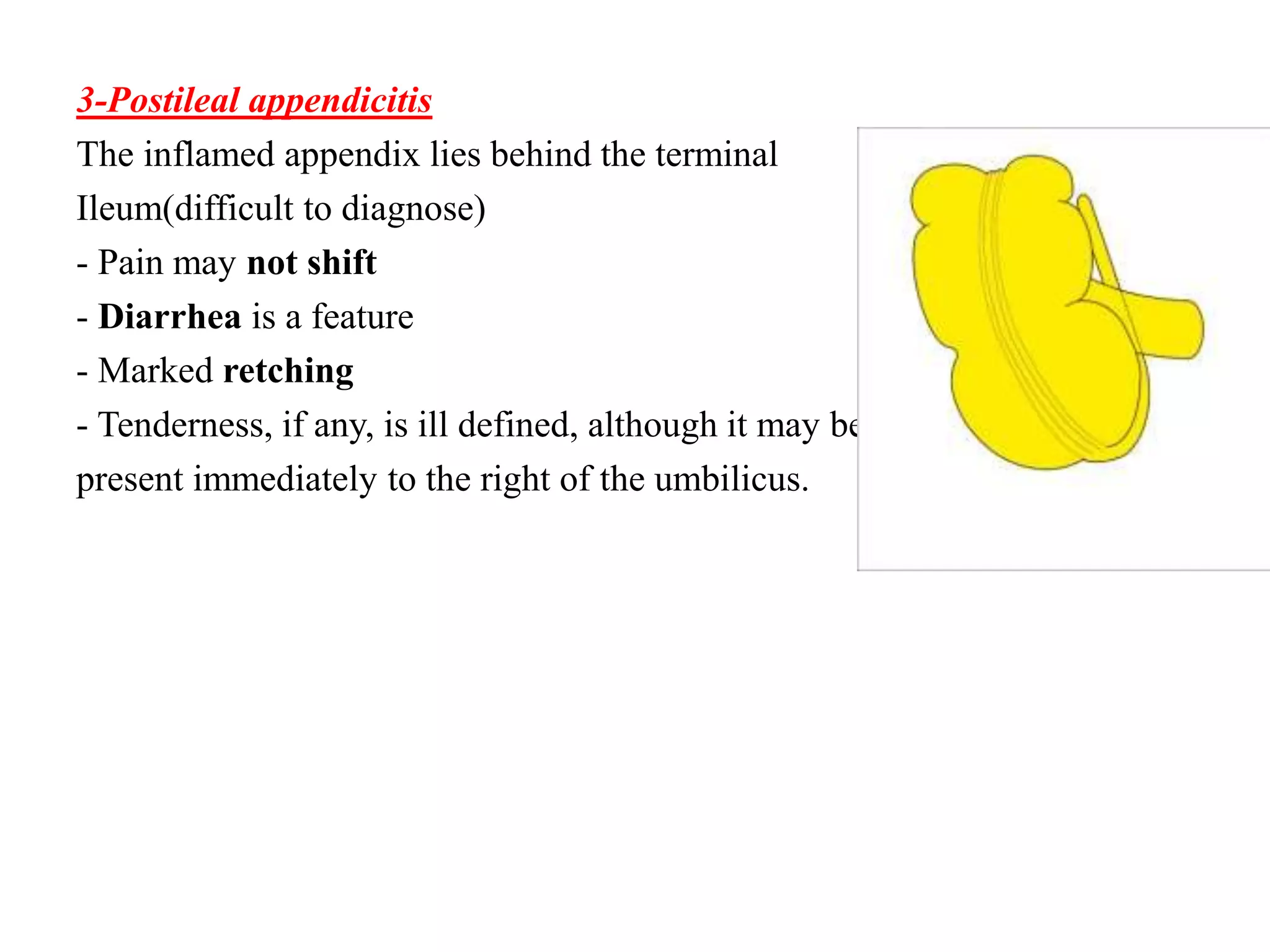 Acute Appendicitis-١.pptx