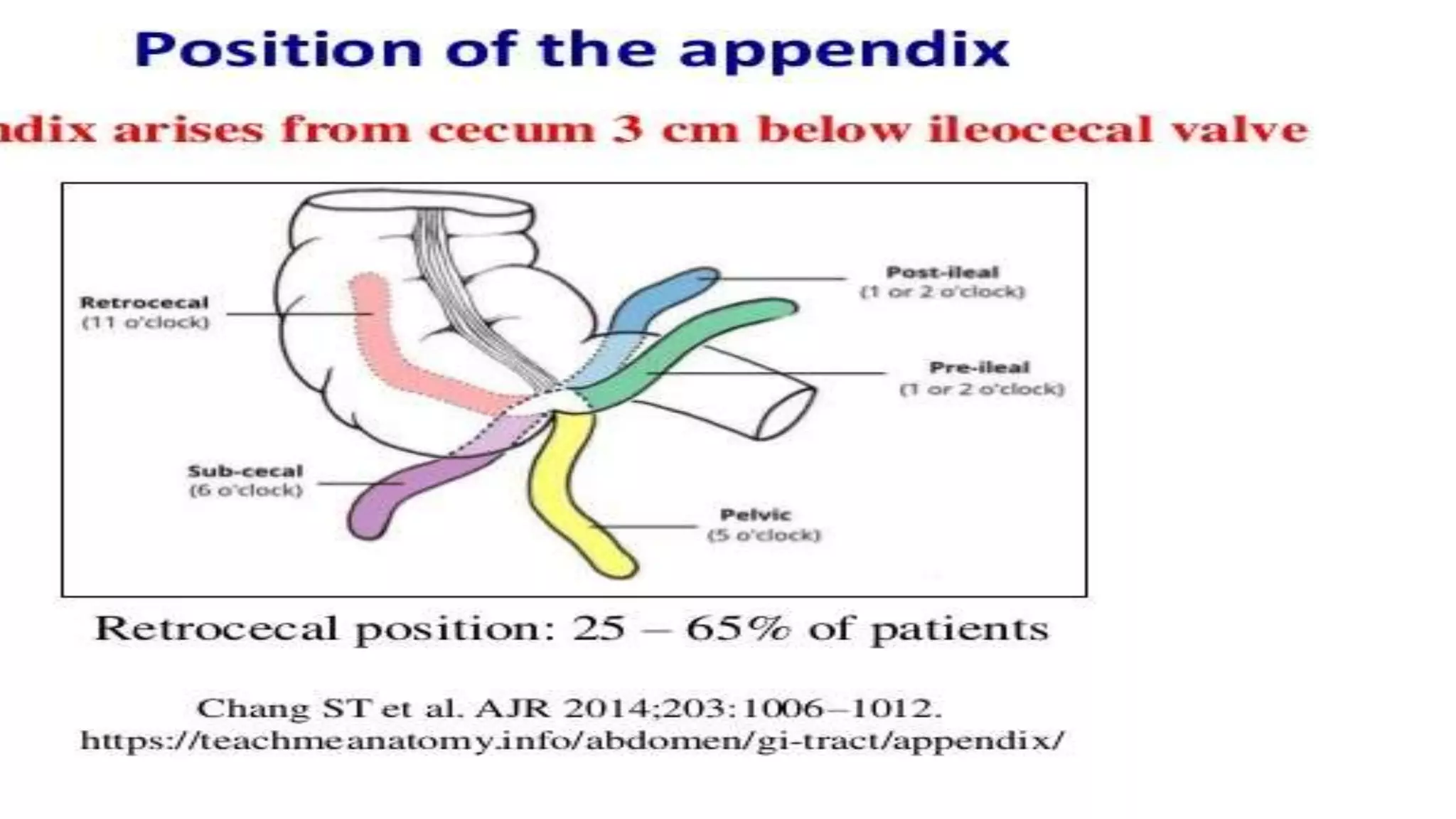 ACUTE APPENDICITIS.pptx | Digestive Disorders | Diseases and Conditions
