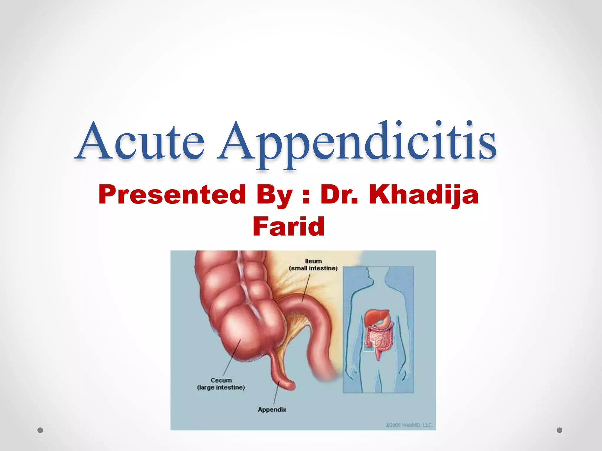 Acute Appendicitis.pptx