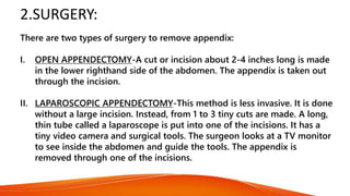 Acute Appendicitis | PPT
