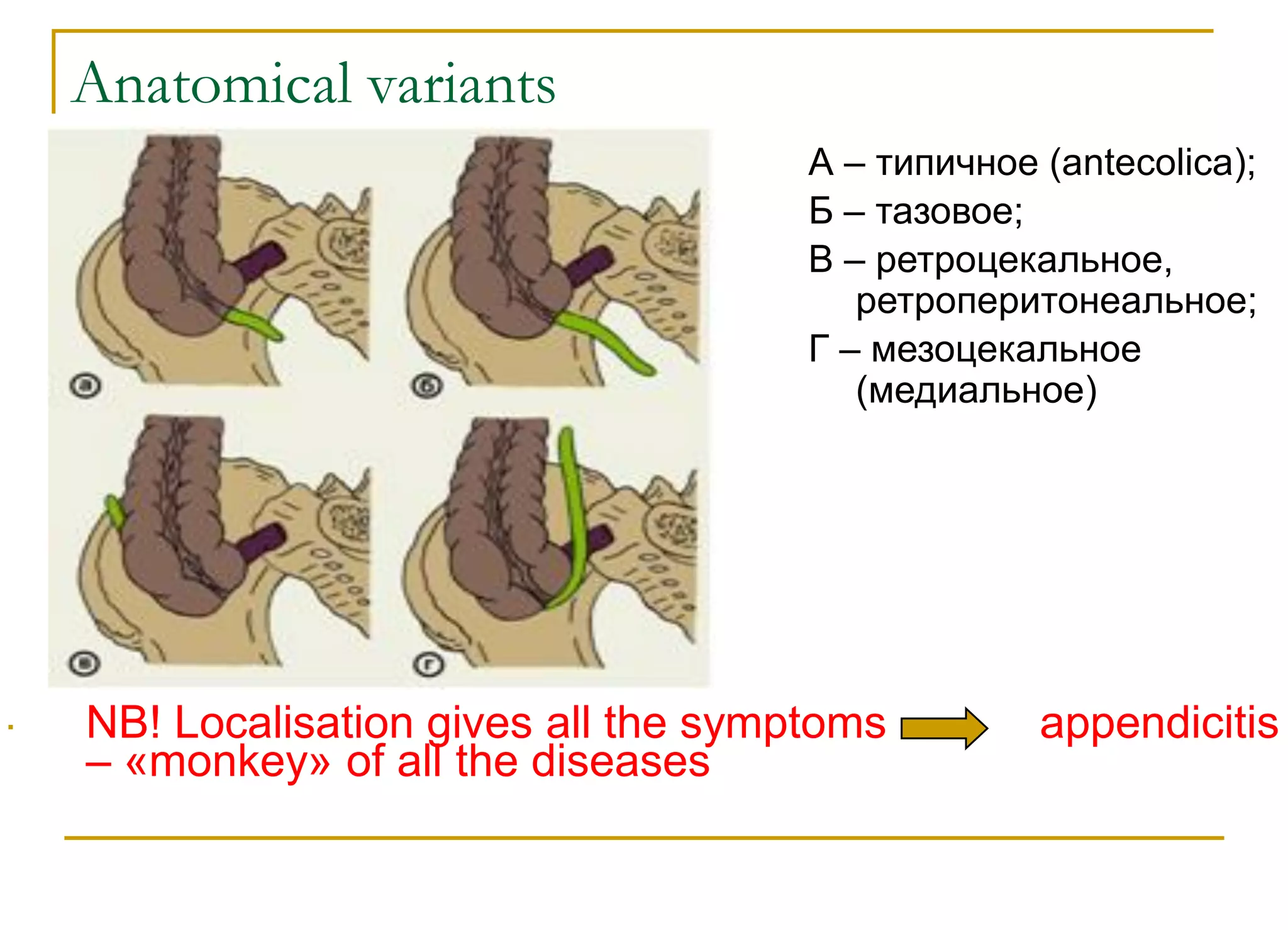 Acute appendicitis.pdf