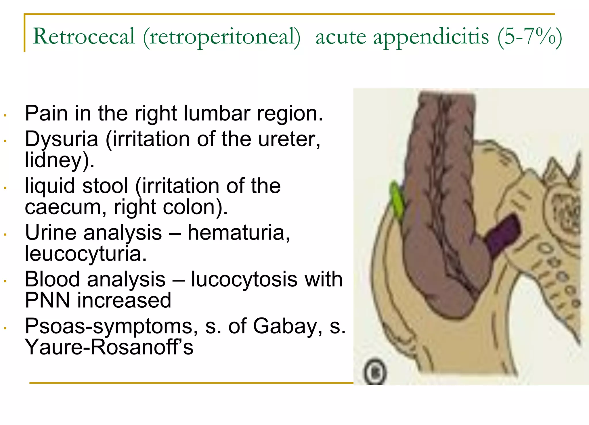 Acute appendicitis.pdf