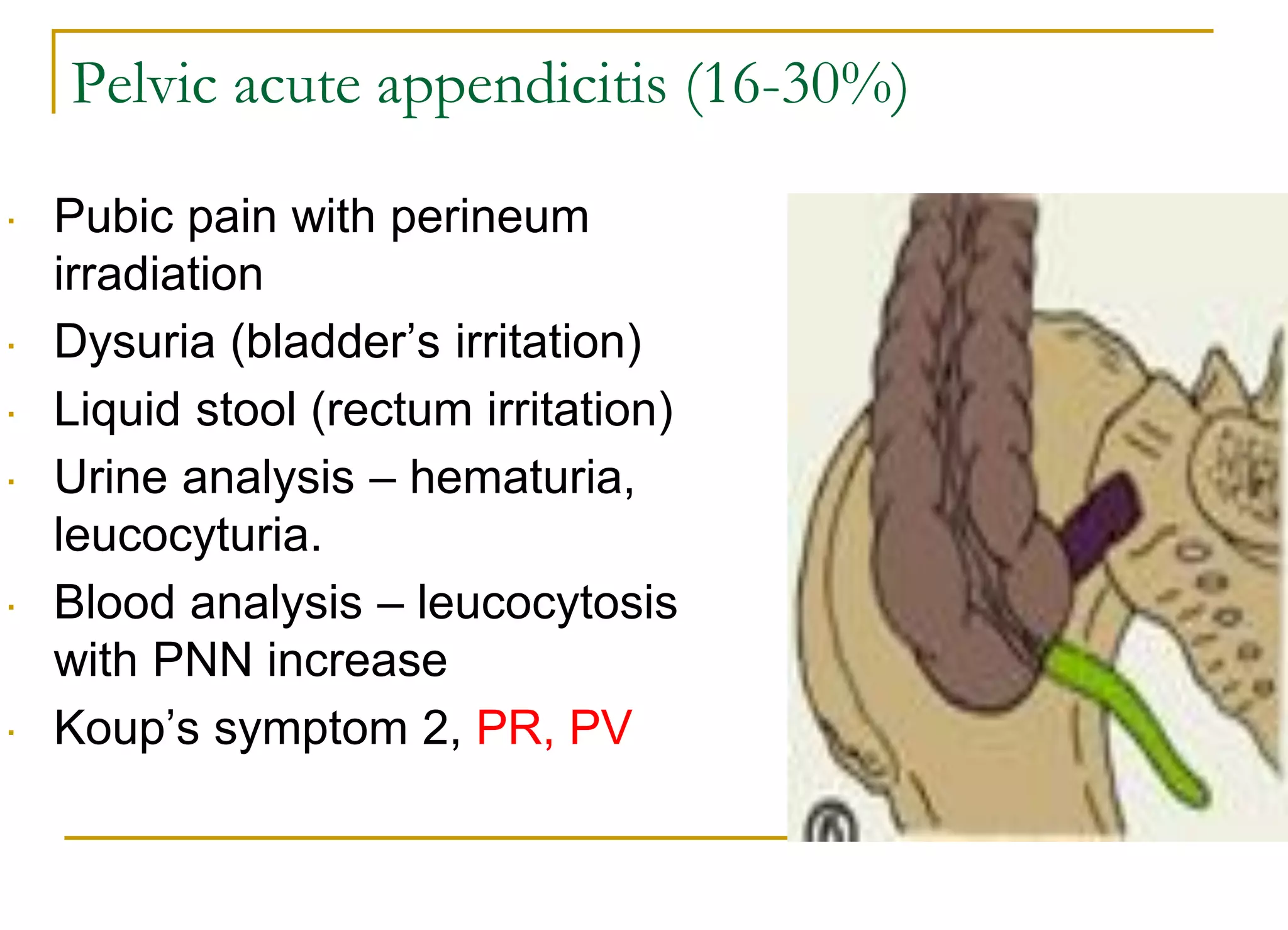 Acute appendicitis.pdf