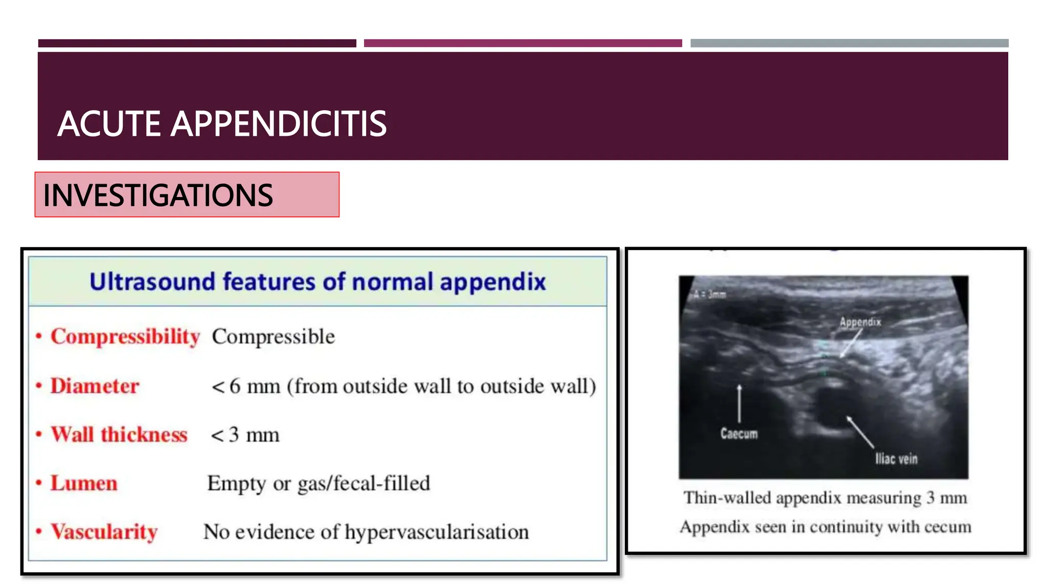 ACUTE APPENDICITIS: anatomy, aetiology, types, clinical features.pptx ...