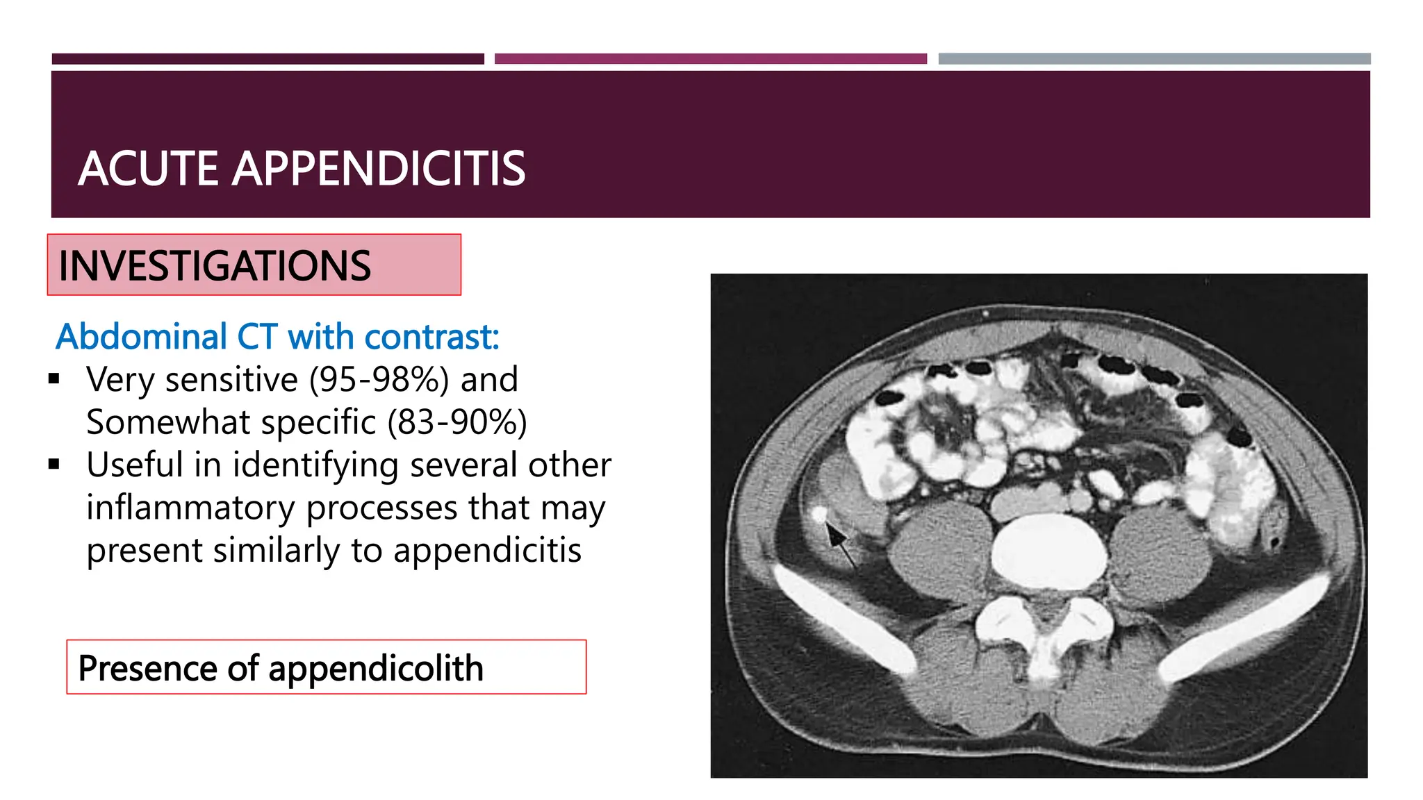 ACUTE APPENDICITIS: anatomy, aetiology, types, clinical features.pptx ...