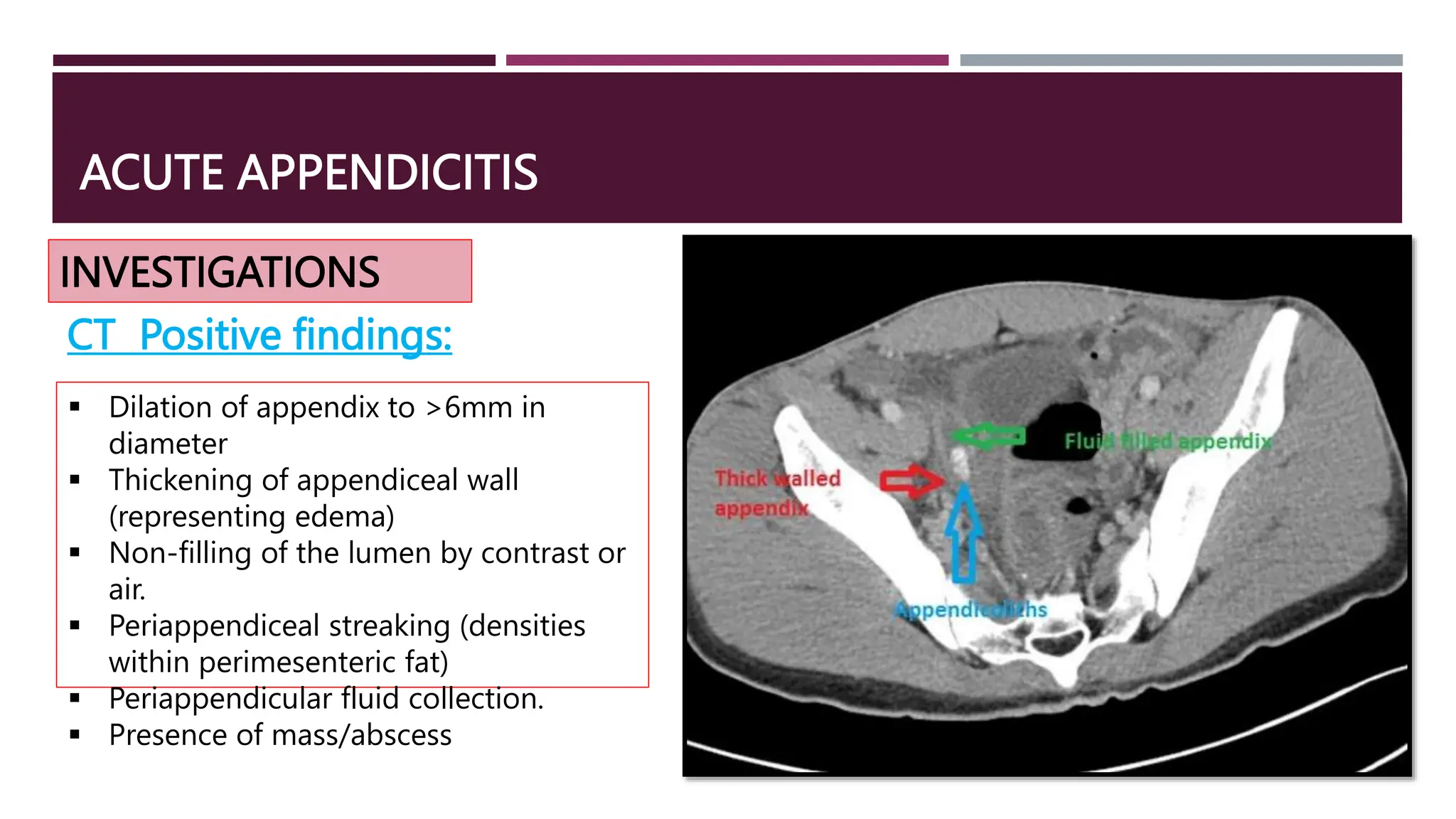 ACUTE APPENDICITIS: anatomy, aetiology, types, clinical features.pptx