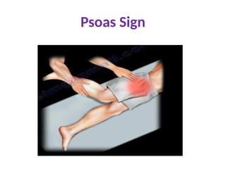 Acute Appendicitis and Homoeopathy...... | PPT