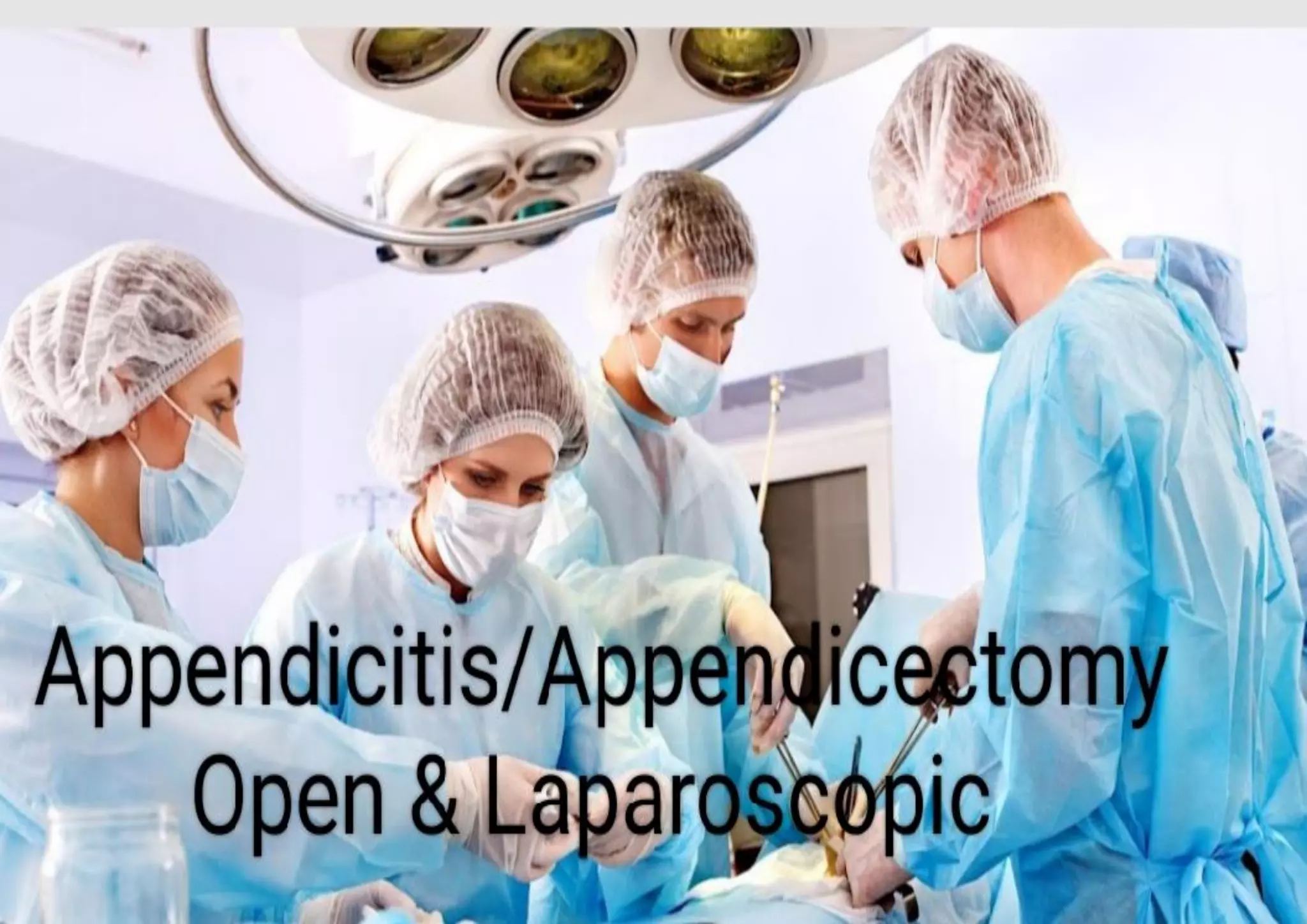 Acute Appendicitis- Appendicectomy- Open & Laparoscopic.pdf