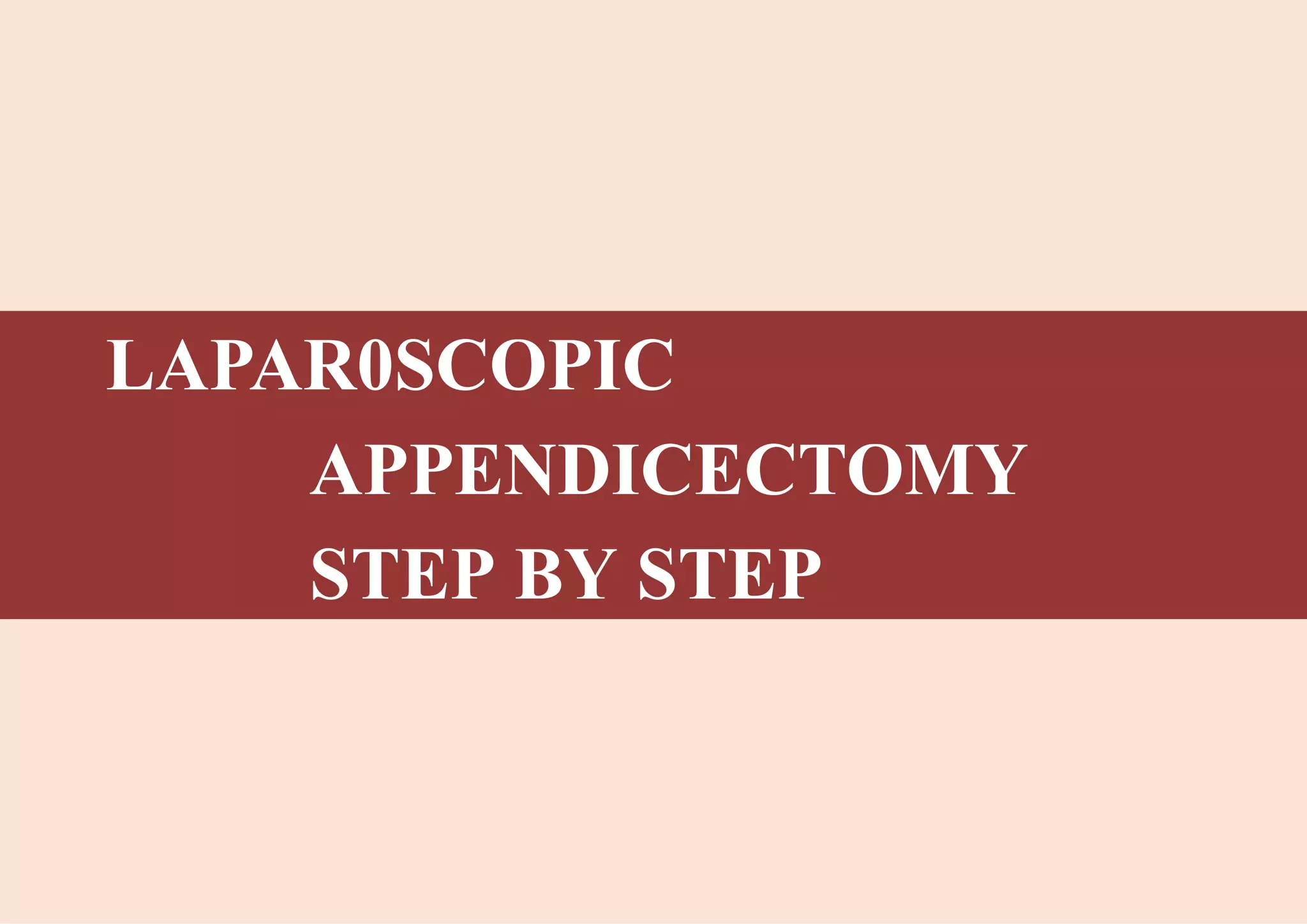 Acute Appendicitis- Appendicectomy- Open & Laparoscopic.pdf