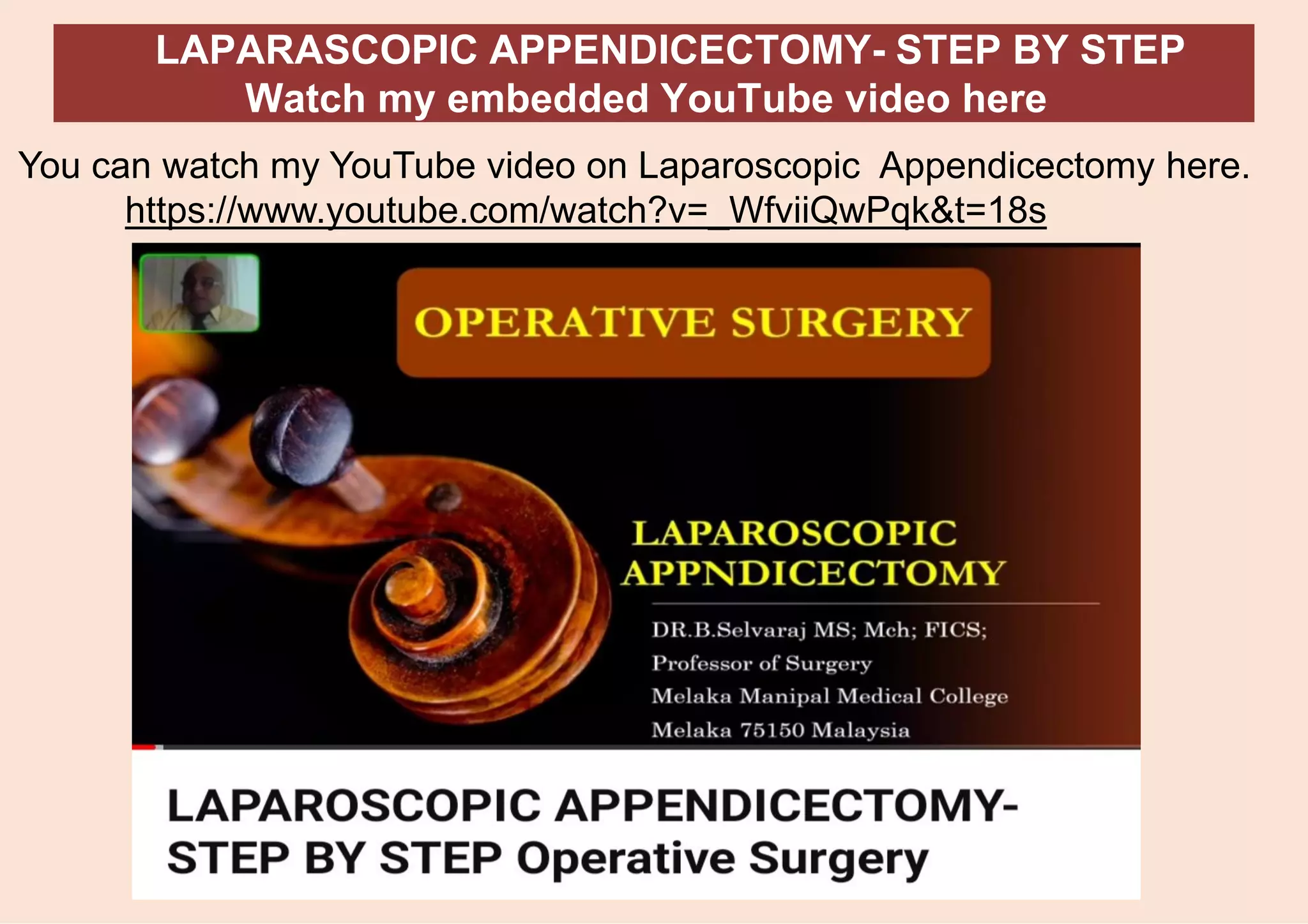 Acute Appendicitis- Appendicectomy- Open & Laparoscopic.pdf
