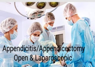 Acute Appendicitis- Appendicectomy- Open & Laparoscopic.pdf | Surgery ...