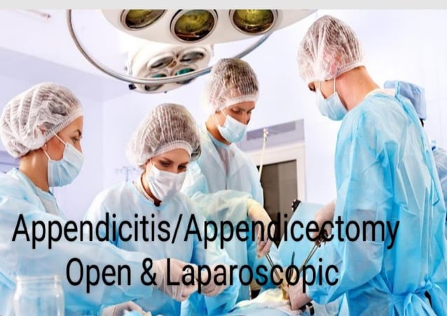 Acute Appendicitis- Appendicectomy- Open & Laparoscopic.pdf | Surgery | Medical Health