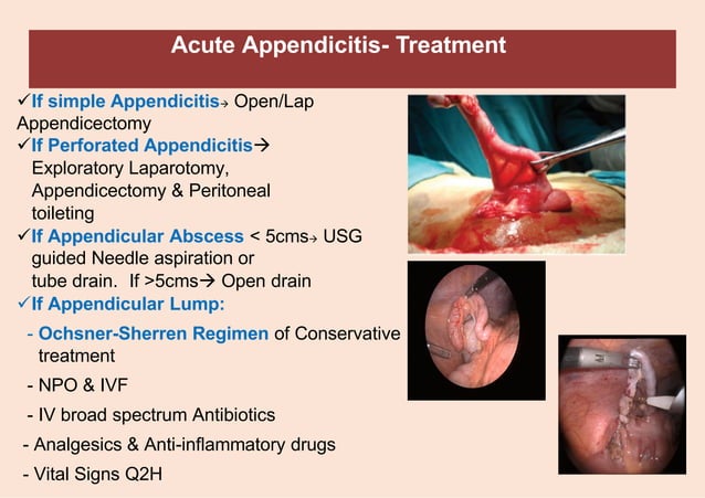 Acute Appendicitis- Appendicectomy- Open & Laparoscopic.pdf | Surgery ...