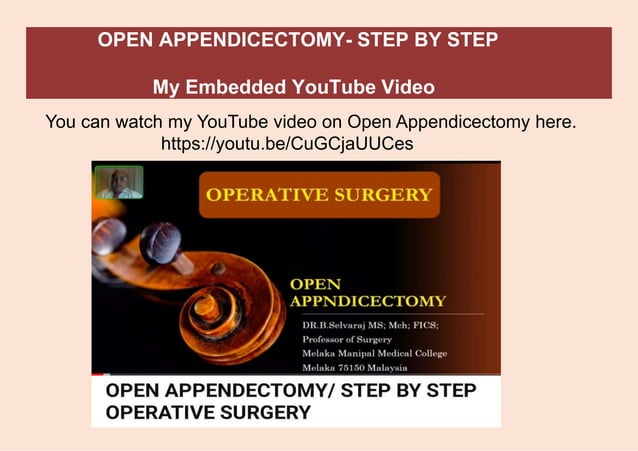 Acute Appendicitis- Appendicectomy- Open & Laparoscopic.pdf | Surgery ...