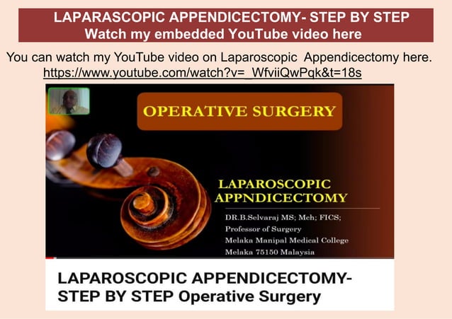 Acute Appendicitis- Appendicectomy- Open & Laparoscopic.pdf | Surgery ...