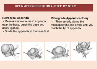 Acute Appendicitis- Appendicectomy- Open & Laparoscopic.pdf